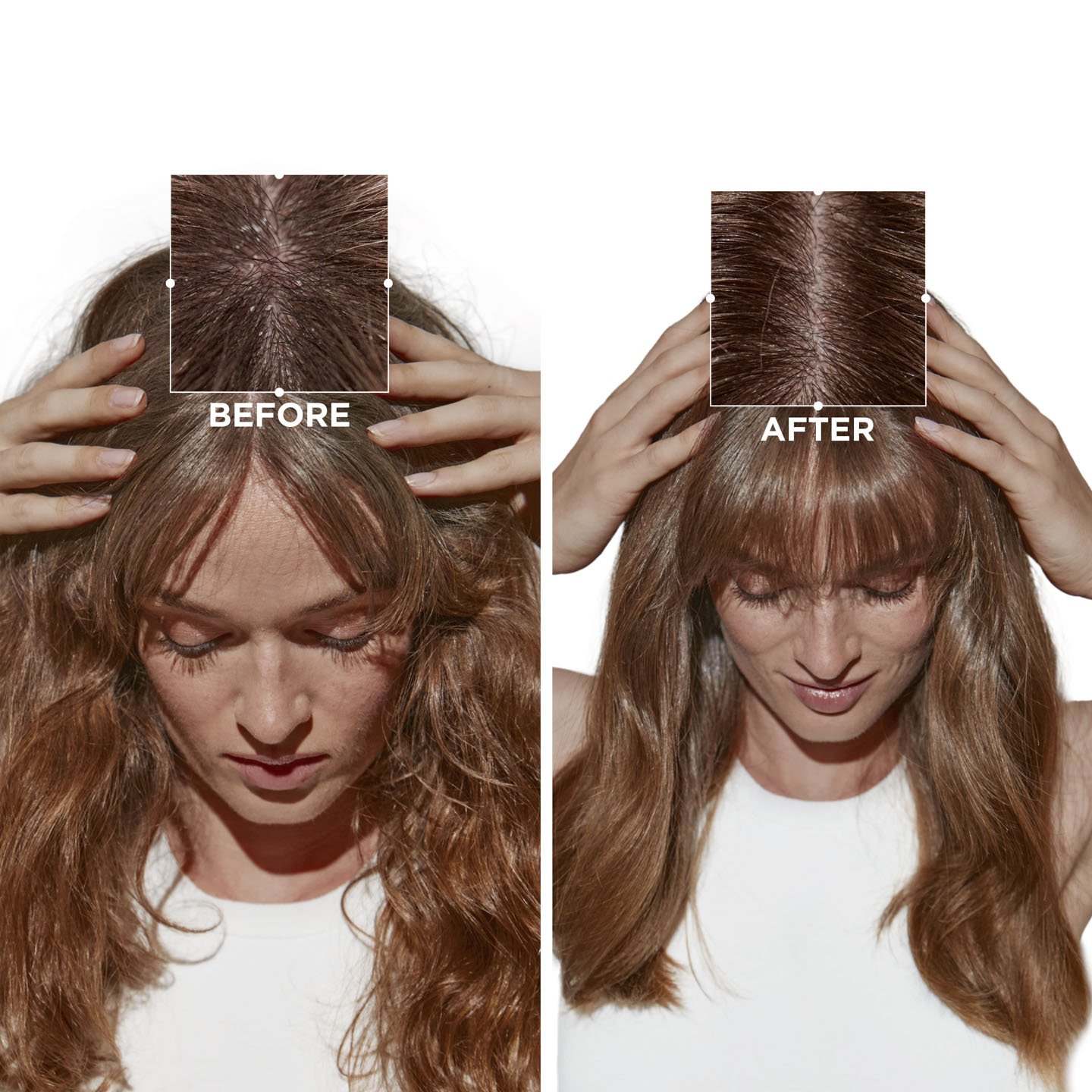 Bain Pureté Anti-Pelliculaire | Anti-Dandruff Shampoo | Symbiose ...